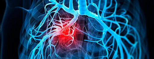 CHEST - American College of Chest Physicians