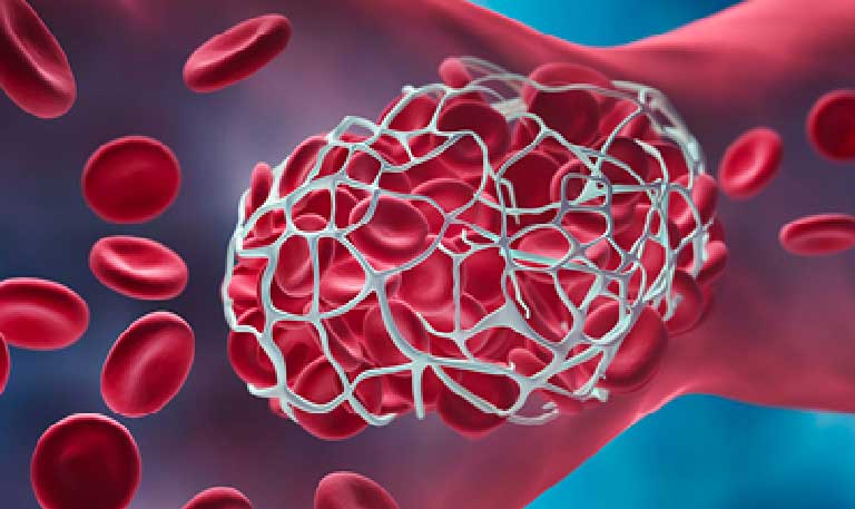 CHEST - American College of Chest Physicians