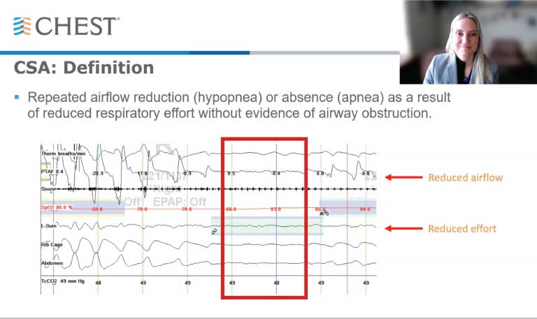 Learning & Events - American College of Chest Physicians