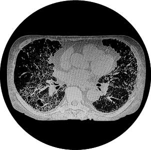 Guidelines & Topic Collections - American College of Chest Physicians